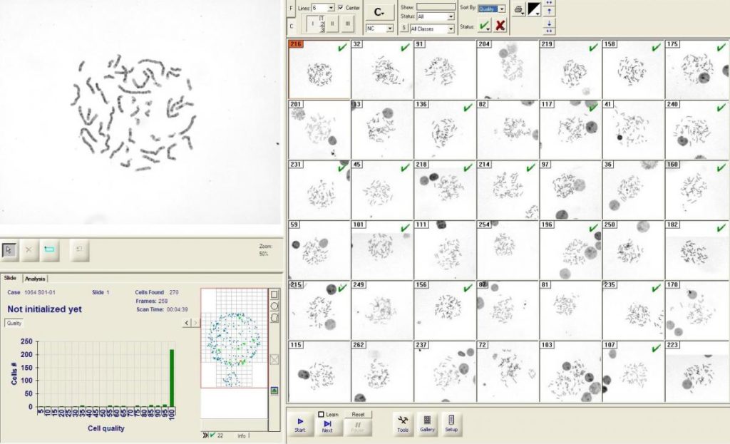 Metaphase Finder для автоматического поиска и анализа метафаз - ТОО ...